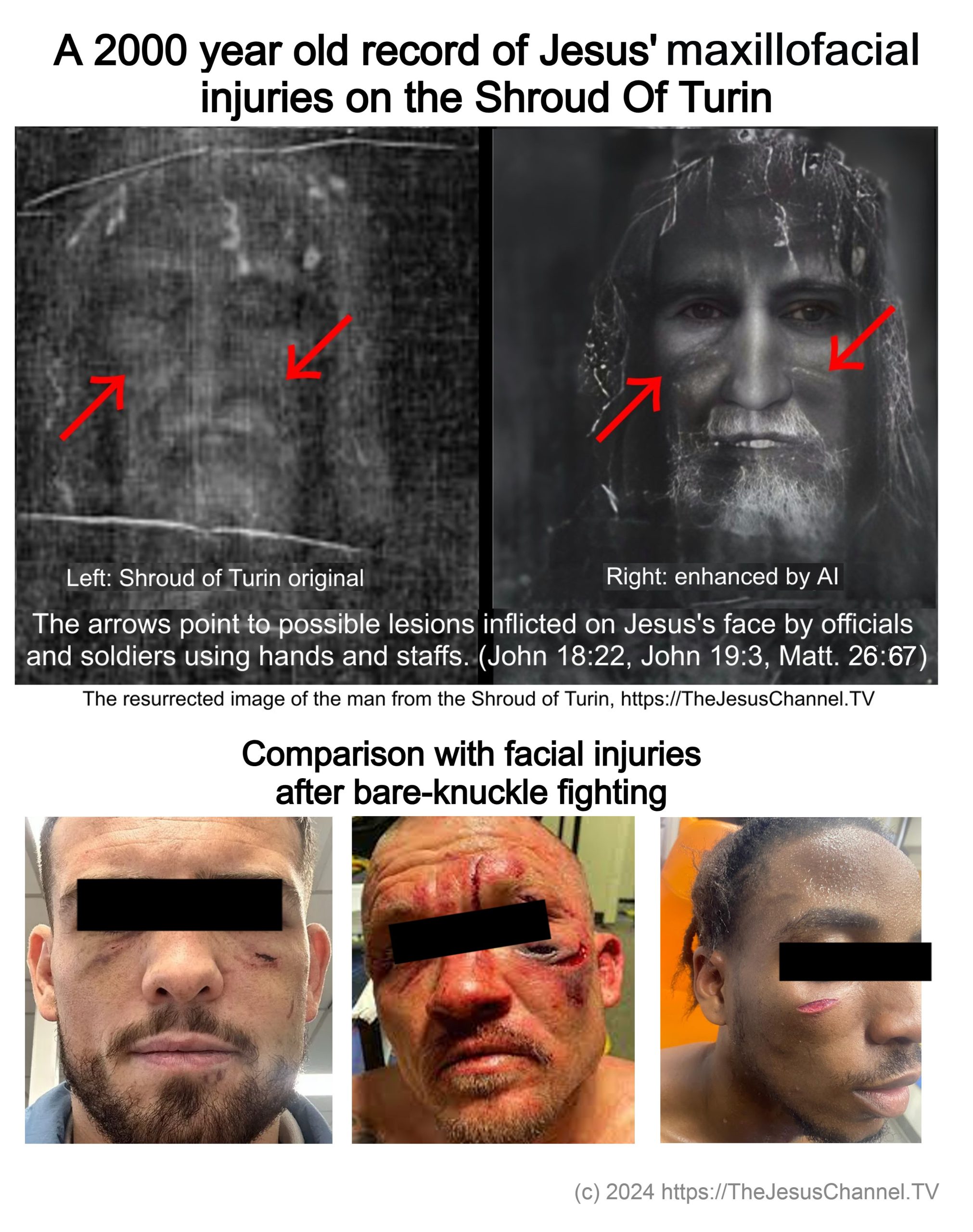 The Passion of Christ: Disturbing Discoveries on the Shroud of Turin ...